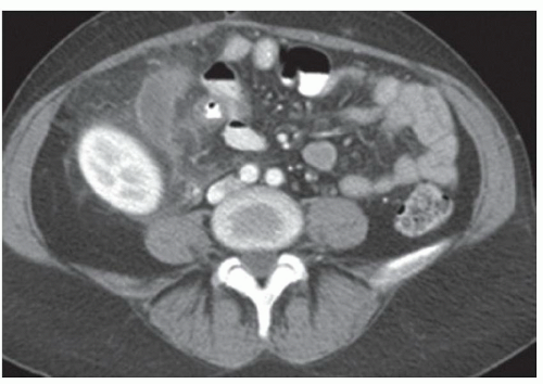 C2-FF232.gif | Abdominal Key