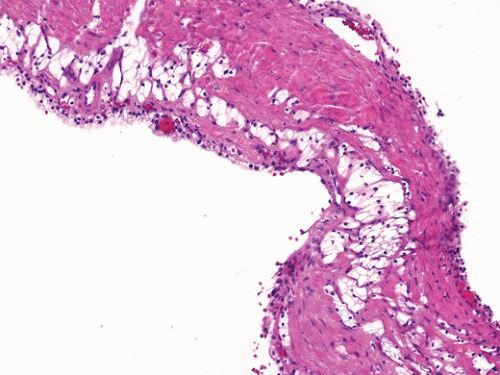 C2-FF25.gif | Abdominal Key
