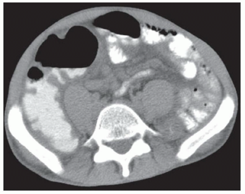 C2-FF253.gif | Abdominal Key