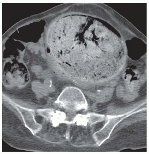 C2-FF266.gif | Abdominal Key