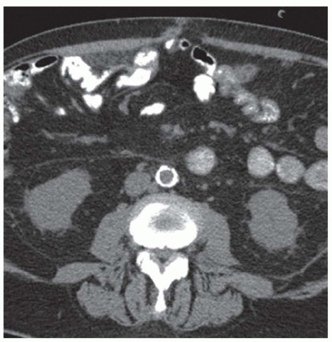 C2-FF294.gif | Abdominal Key