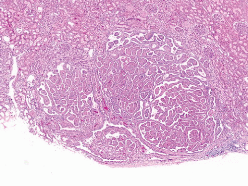 C2-FF3.gif | Abdominal Key