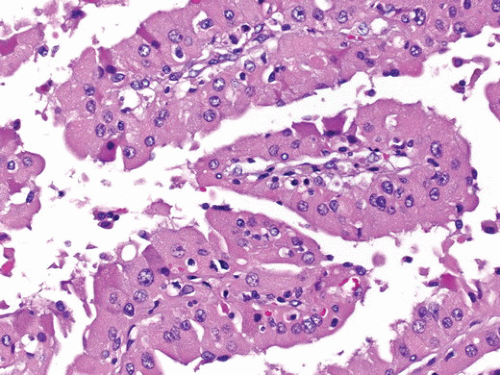 C2-FF31.gif | Abdominal Key