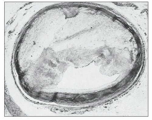 C20-FF30.gif | Abdominal Key