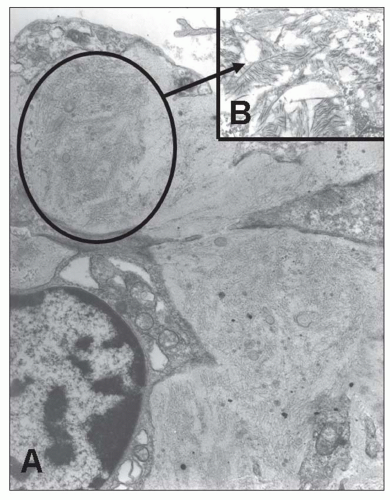 C23-FF20.gif | Abdominal Key