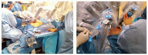 C29-FF12.gif | Abdominal Key