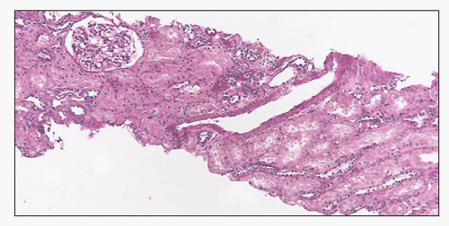 C29-FF67.gif | Abdominal Key