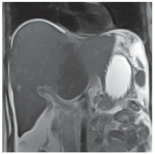 C3-FF121.gif | Abdominal Key