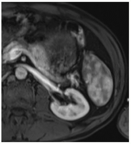 C3-FF226.gif | Abdominal Key