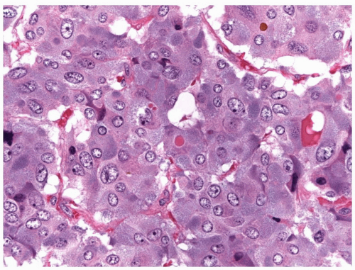 C3-FF23.gif | Abdominal Key