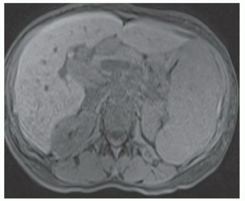 C3-FF232.gif | Abdominal Key