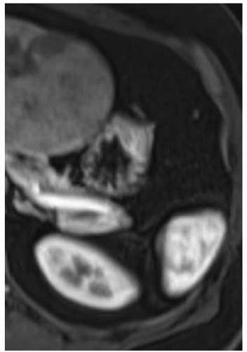 C3-FF253.gif | Abdominal Key
