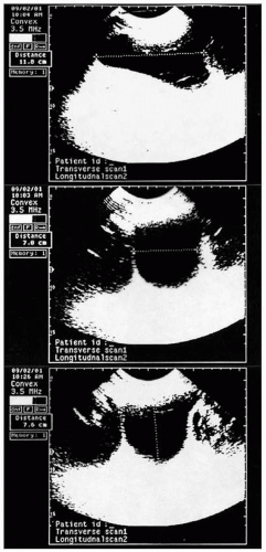 C3-FF30.gif | Abdominal Key