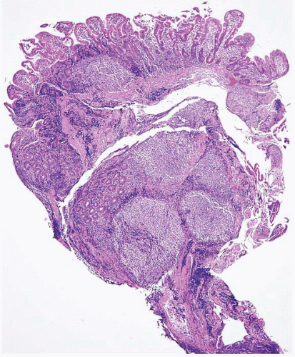 C3-FF30.gif | Abdominal Key