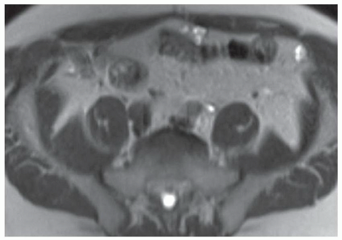C3-FF302.gif | Abdominal Key