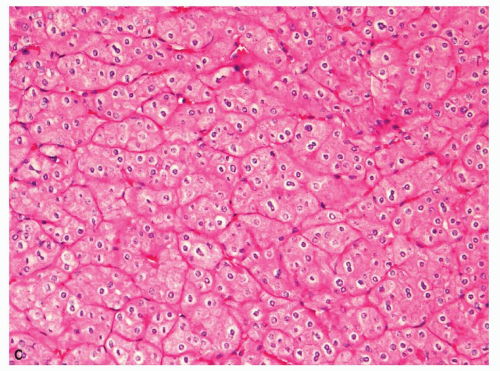 C3-FF46.gif | Abdominal Key