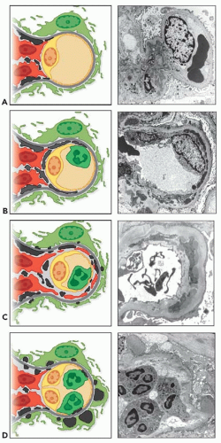 C3-FF6.gif | Abdominal Key