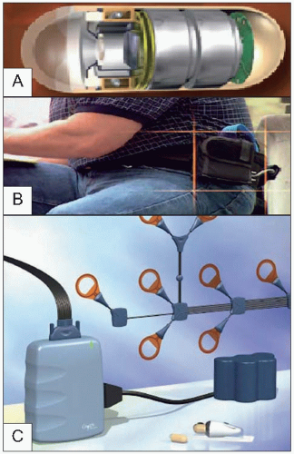 C3-FF8.gif | Abdominal Key
