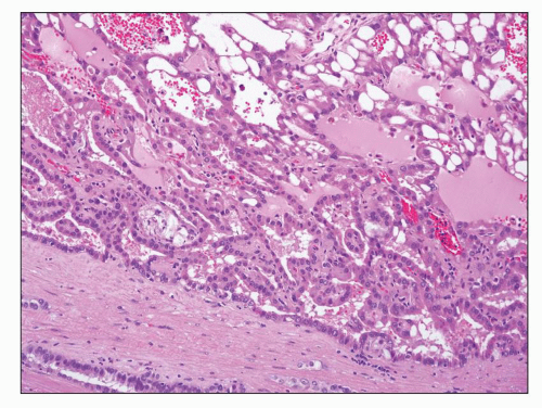 C30-FF30.gif | Abdominal Key