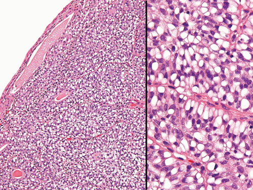 C4-FF12.gif | Abdominal Key