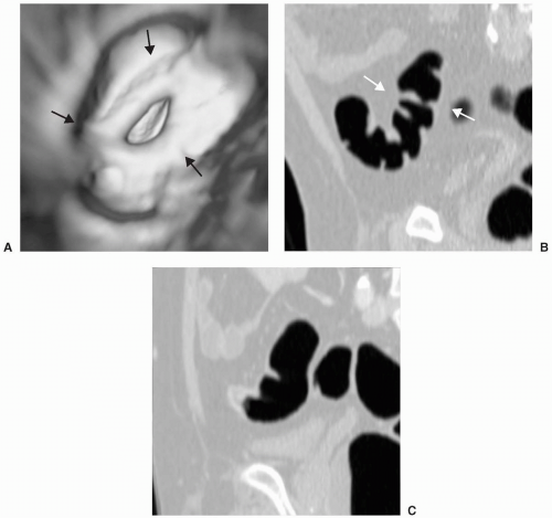C4-FF19.gif | Abdominal Key