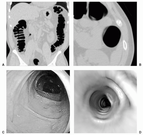 C4-FF30.gif | Abdominal Key