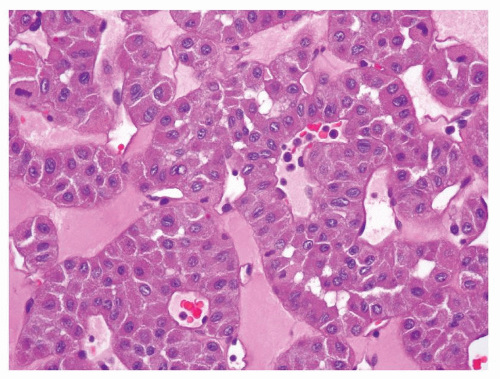C5-FF10.gif | Abdominal Key