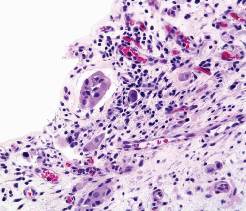 C5-FF11.gif | Abdominal Key