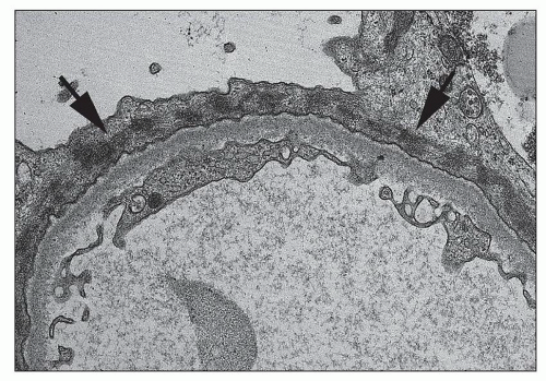 C5-FF11.gif | Abdominal Key