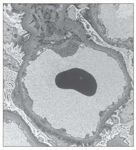 C5-FF12.gif | Abdominal Key
