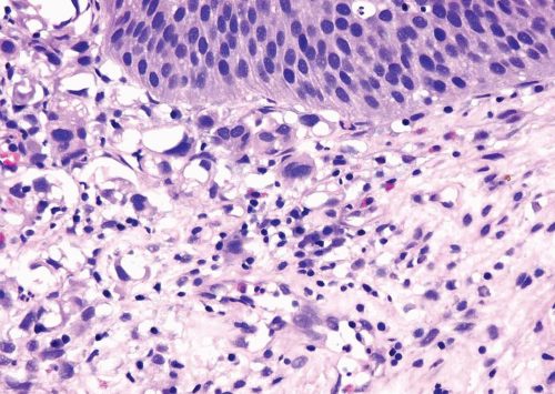 C5-FF15.gif | Abdominal Key