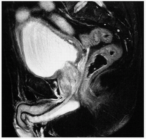 C5-FF17.gif | Abdominal Key
