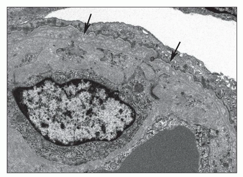 C5-FF17.gif | Abdominal Key
