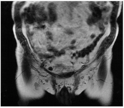 C5-FF19.gif | Abdominal Key