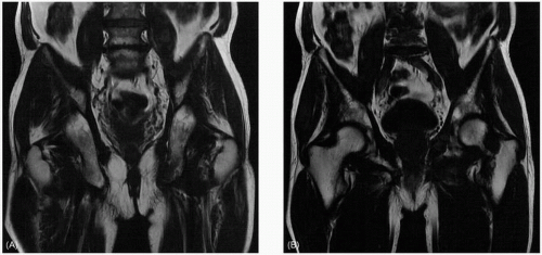 C5-FF20.gif | Abdominal Key