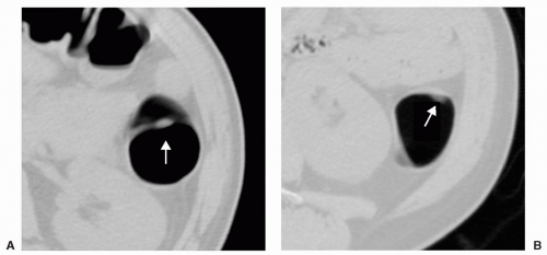 C5-FF21.gif | Abdominal Key