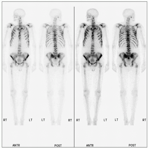 C5-FF23.gif | Abdominal Key