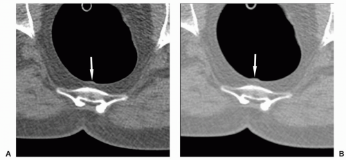 C5-FF25.gif | Abdominal Key