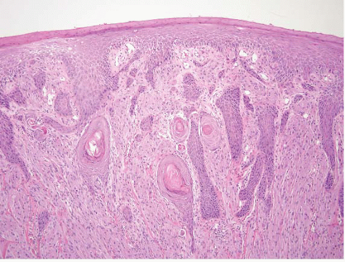 C5-FF27.gif | Abdominal Key