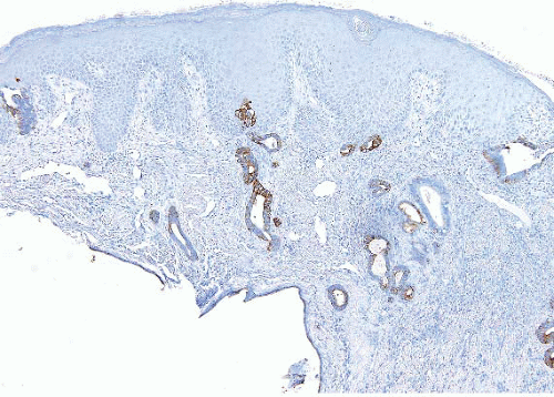 C5-FF37.gif | Abdominal Key