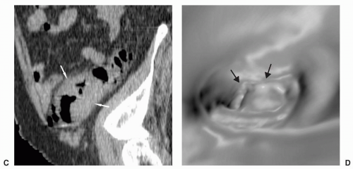 C5-FF37.gif | Abdominal Key