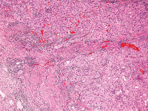 C5-FF38.gif | Abdominal Key