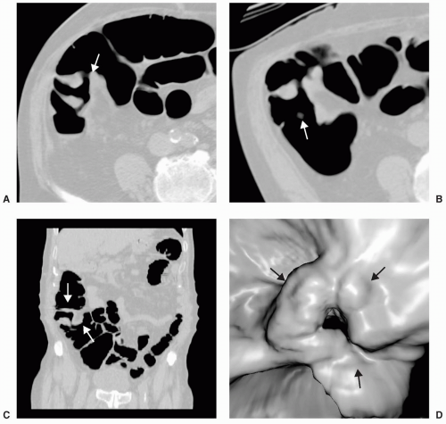 C5-FF39.gif | Abdominal Key
