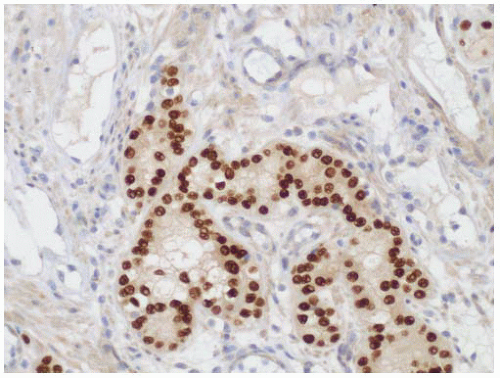 C5-FF50.gif | Abdominal Key