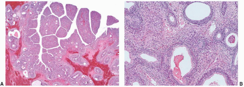 C5-FF53.gif | Abdominal Key