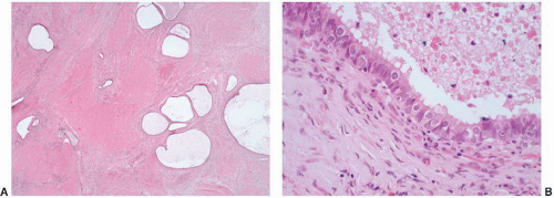 C5-FF57.gif | Abdominal Key