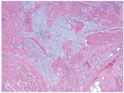 C5-FF59.gif | Abdominal Key