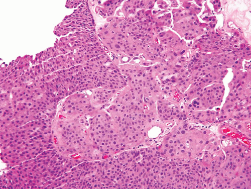 C5-FF6.gif | Abdominal Key
