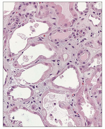 C5-FF8.gif | Abdominal Key