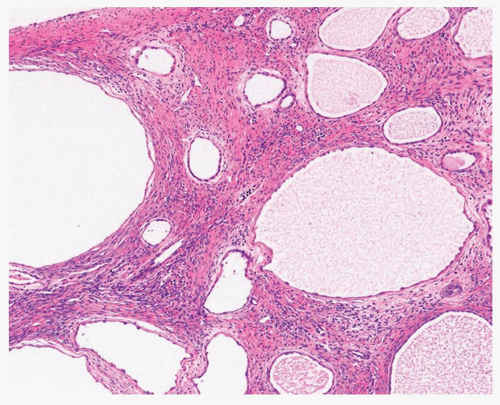 C6-FF12.gif | Abdominal Key